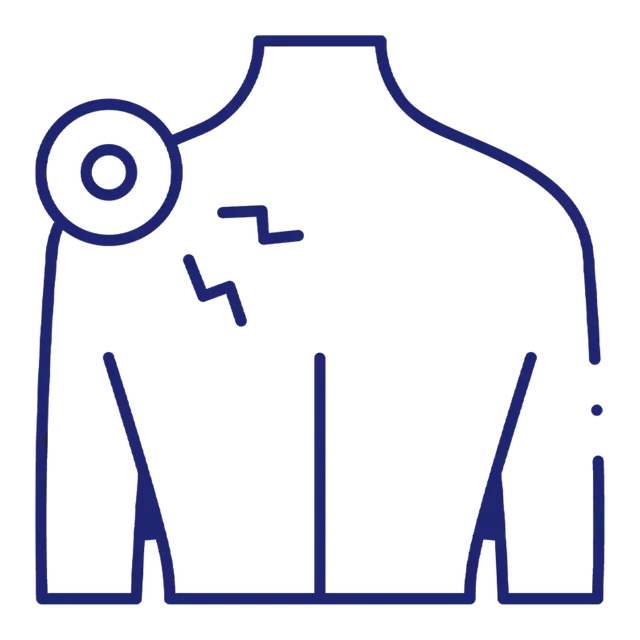 Shoulder Dislocation Surgery & Treatment | Texas Ortho Associates