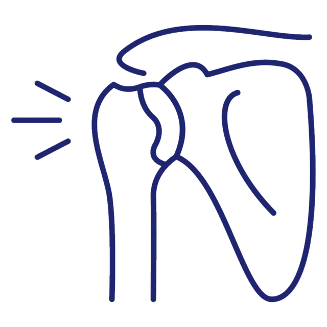 Rotator Cuff Specialist | Texas Ortho Associates