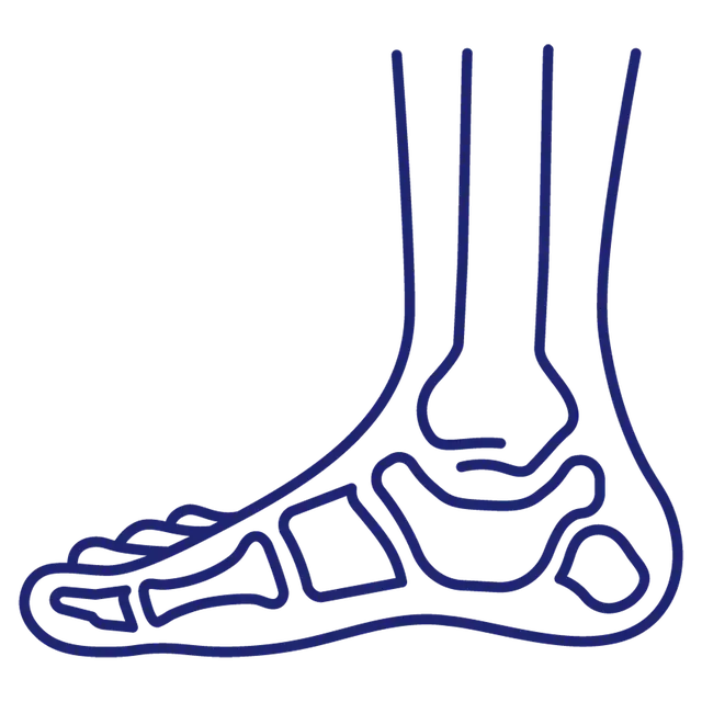 Ankle Deformity Correction | Texas Ortho Associates